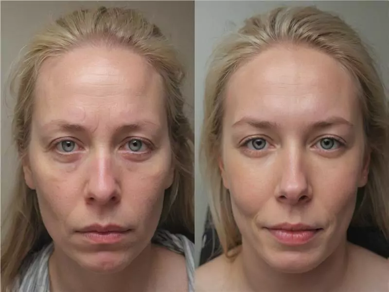 DeepSleep Bliss ™ | Official Website | Sleep Support Backed by Science